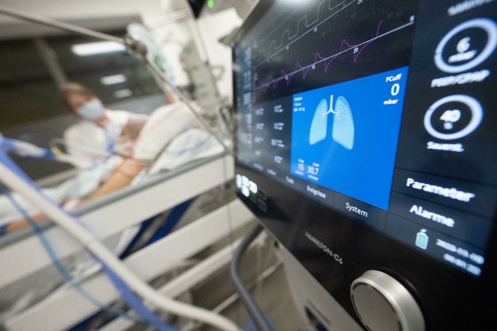 Long Flu statt Long Covid: Schwere Langzeitfolgen sind auch bei Grippe ...